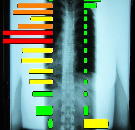 Tytron Thermography - Titronics Research & Development, Inc