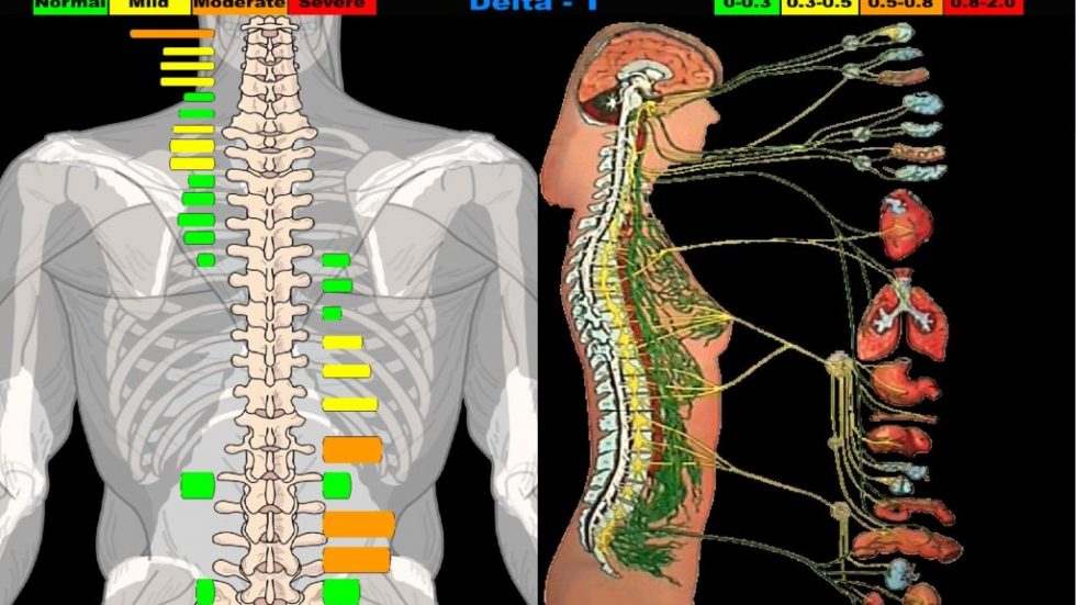 Dysautonomia - Titronics Research & Development, Inc